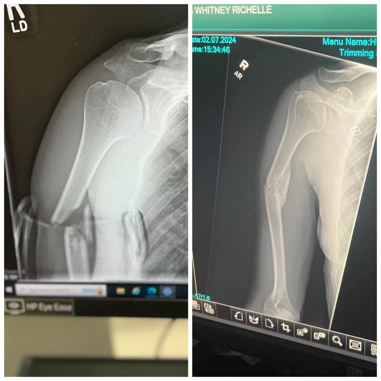 Whitney Davis | Adventist Health White Memorial